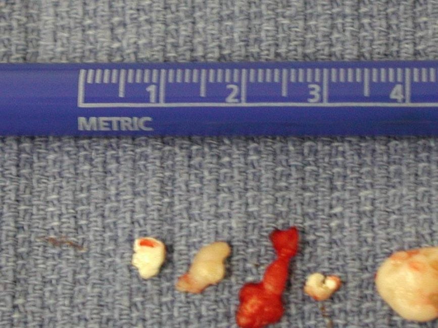 Goldfish - Exploring Hand Therapy